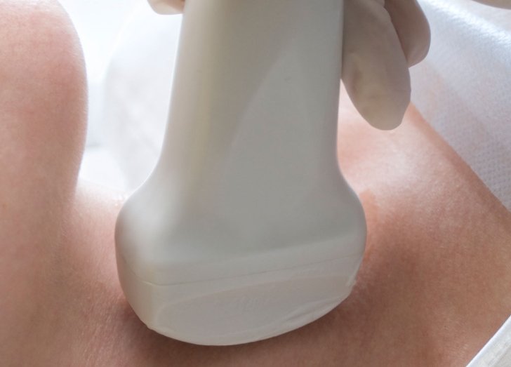 Clinical Approach to Vascular Ultrasound and RPVI Prep | Harvard ...